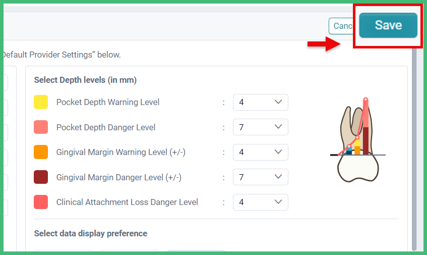 Explore the Different Options in Perio Chart & Perio Chart Settings ...